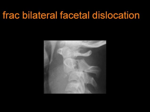 59-Dr Ahmed Esawy imaging oral board MSK imaging part V fracture B ...