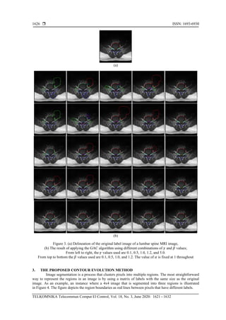 Contour evolution method for precise boundary delineation of medical ...