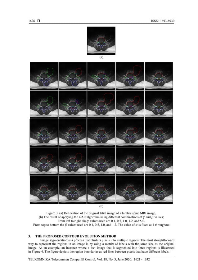 Contour evolution method for precise boundary delineation of medical ...