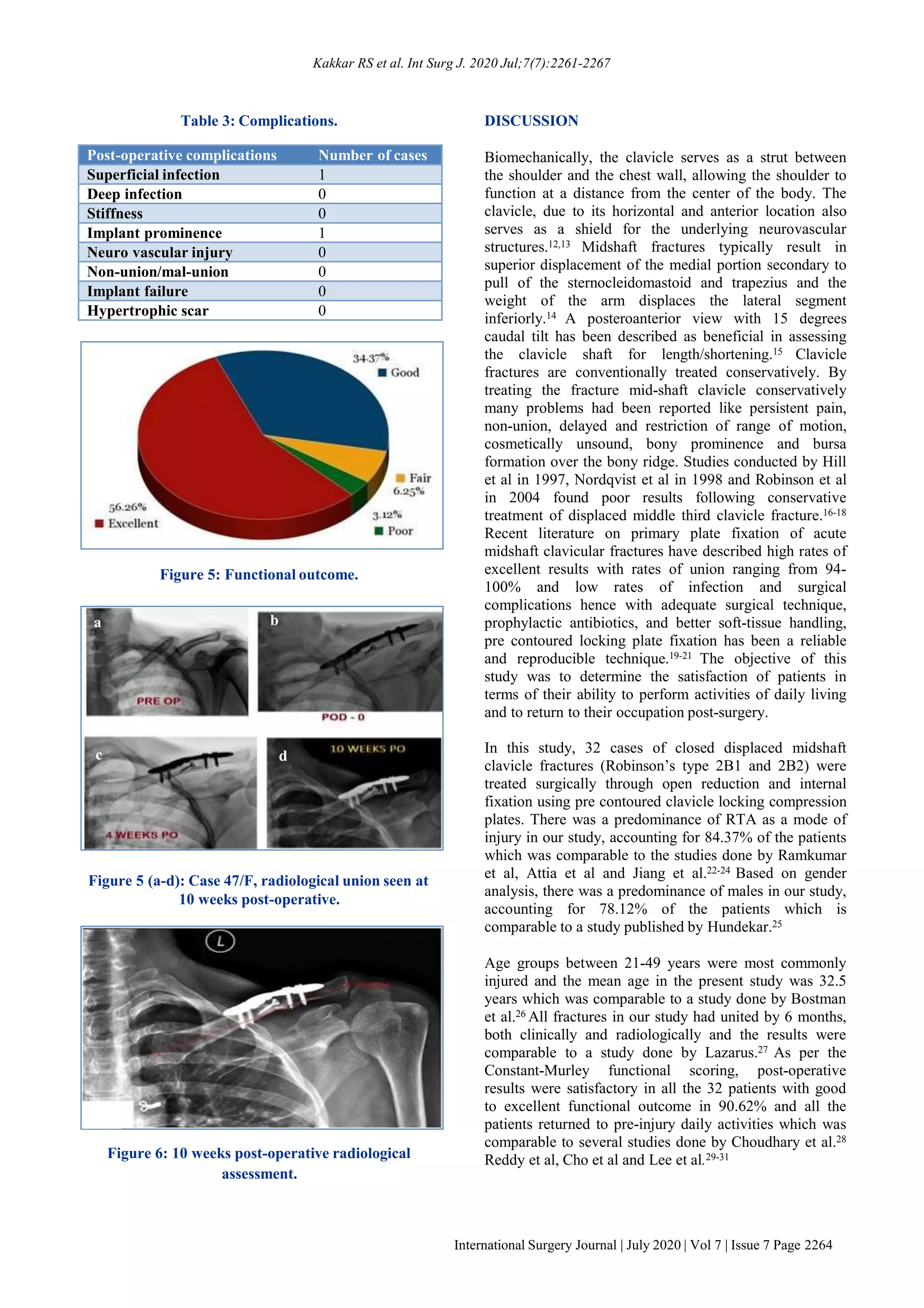 CLAVICLE FRACTURE BIOMECHANICS AND SURGERY | PPTX
