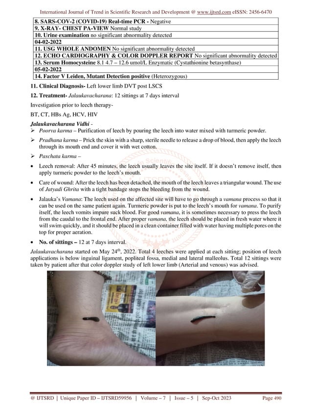 Leech Therapy in DVT Deep Venous Thrombus A Case Study | PDF