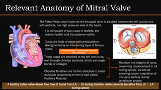 Mitral Valve anatomy and its Disorders.pptx