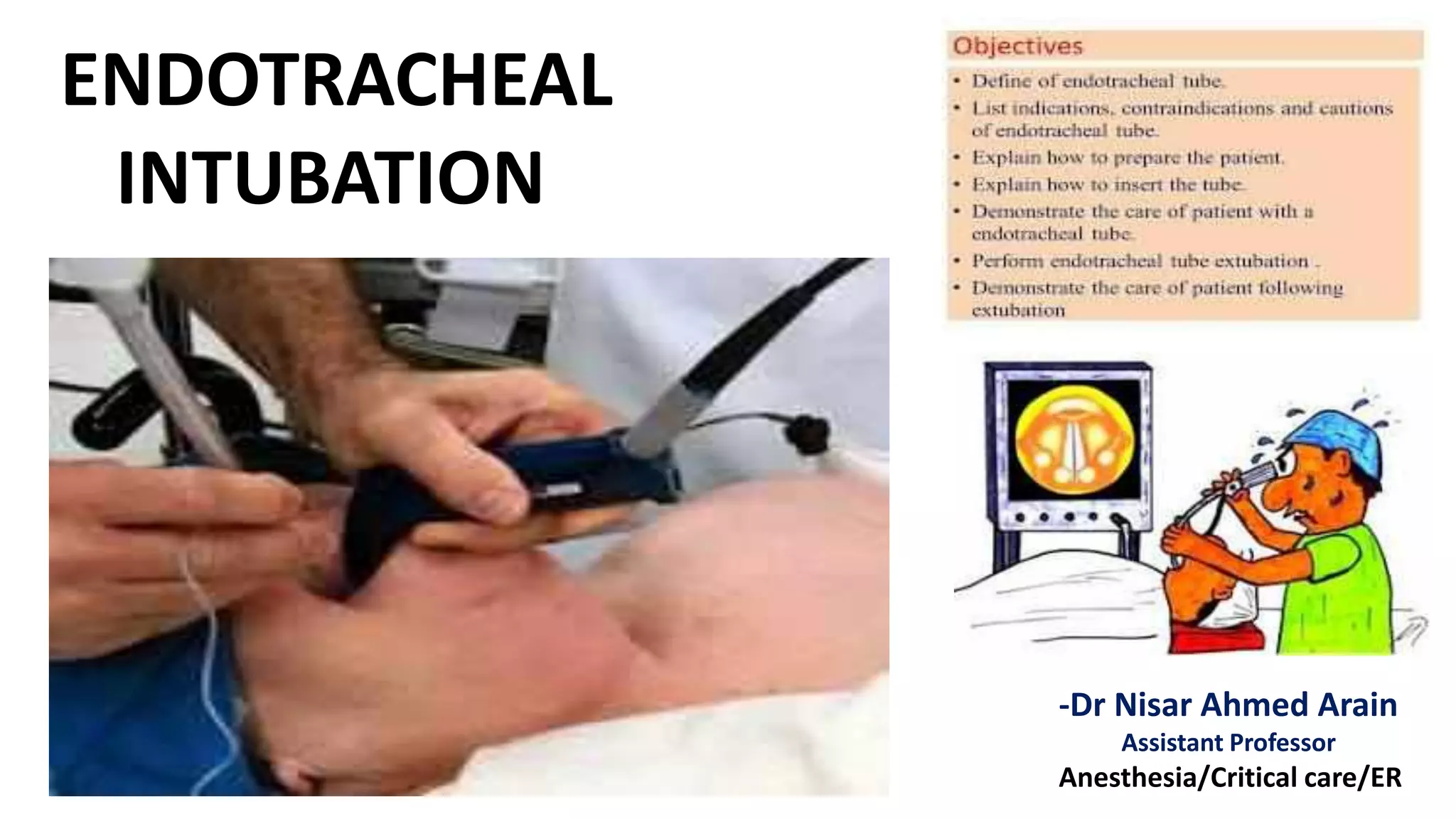 intubation part-1-Anesthesia | PDF