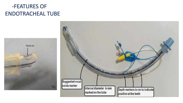 intubation part-1-Anesthesia | PDF | Ear, Nose and Throat Conditions ...