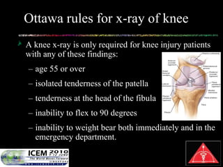 Ottawa Clinical Decision Rule - A Prospective, Validation Study for use ...