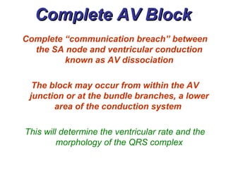 Atrioventricular Blocks - BMH/Tele | PPT | Heart and Cardiovascular ...