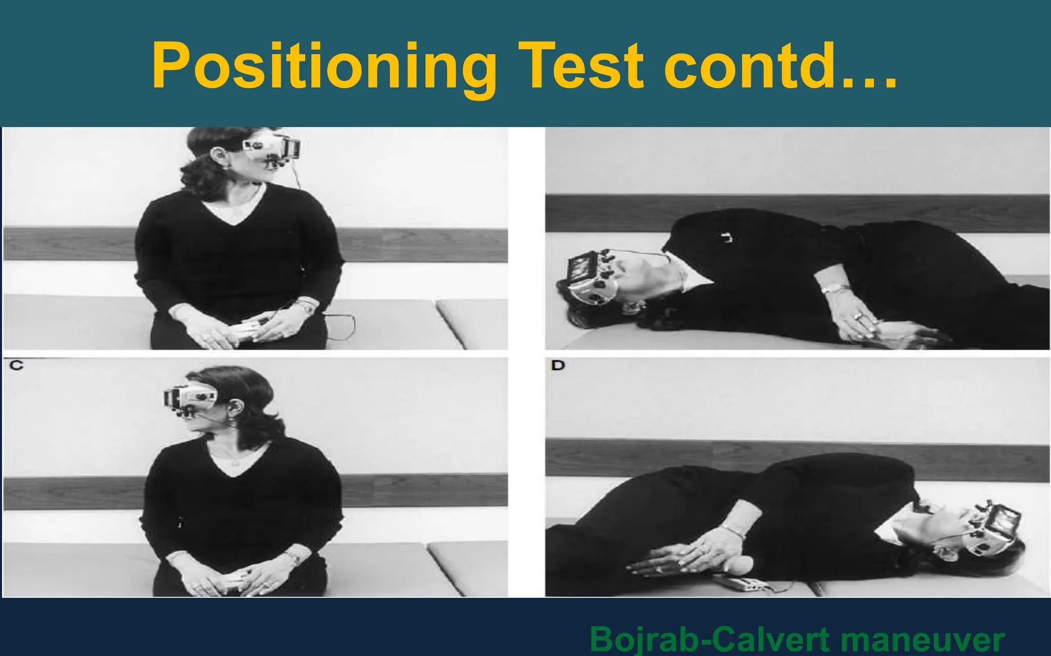Vestibular_tests_sundar in otolaryngology .pptx