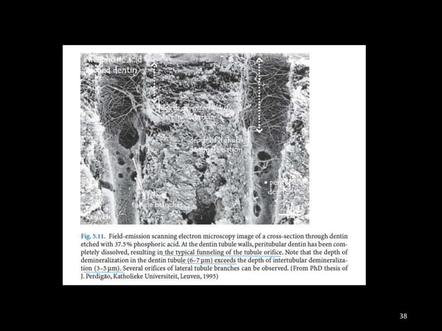 5 adhesion to dental tooth tissues 1 | PPT