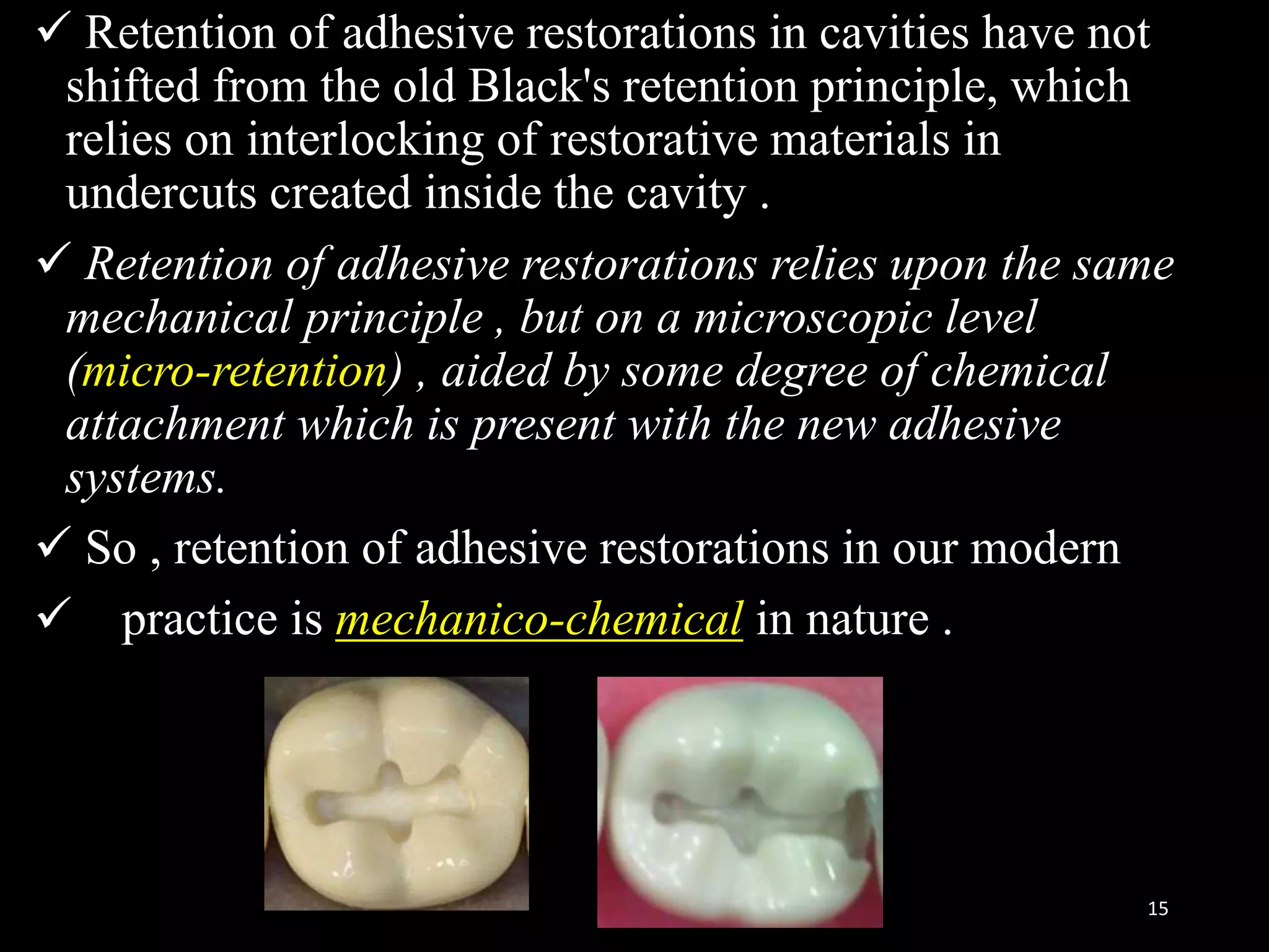 5 adhesion to dental tooth tissues 1 | PPTX