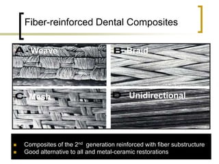 advances in resin composites dental material | PPS