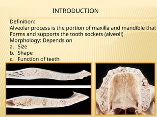 ALVEOLAR BONE, composition, functions.pptx | Bone and Joint Conditions ...