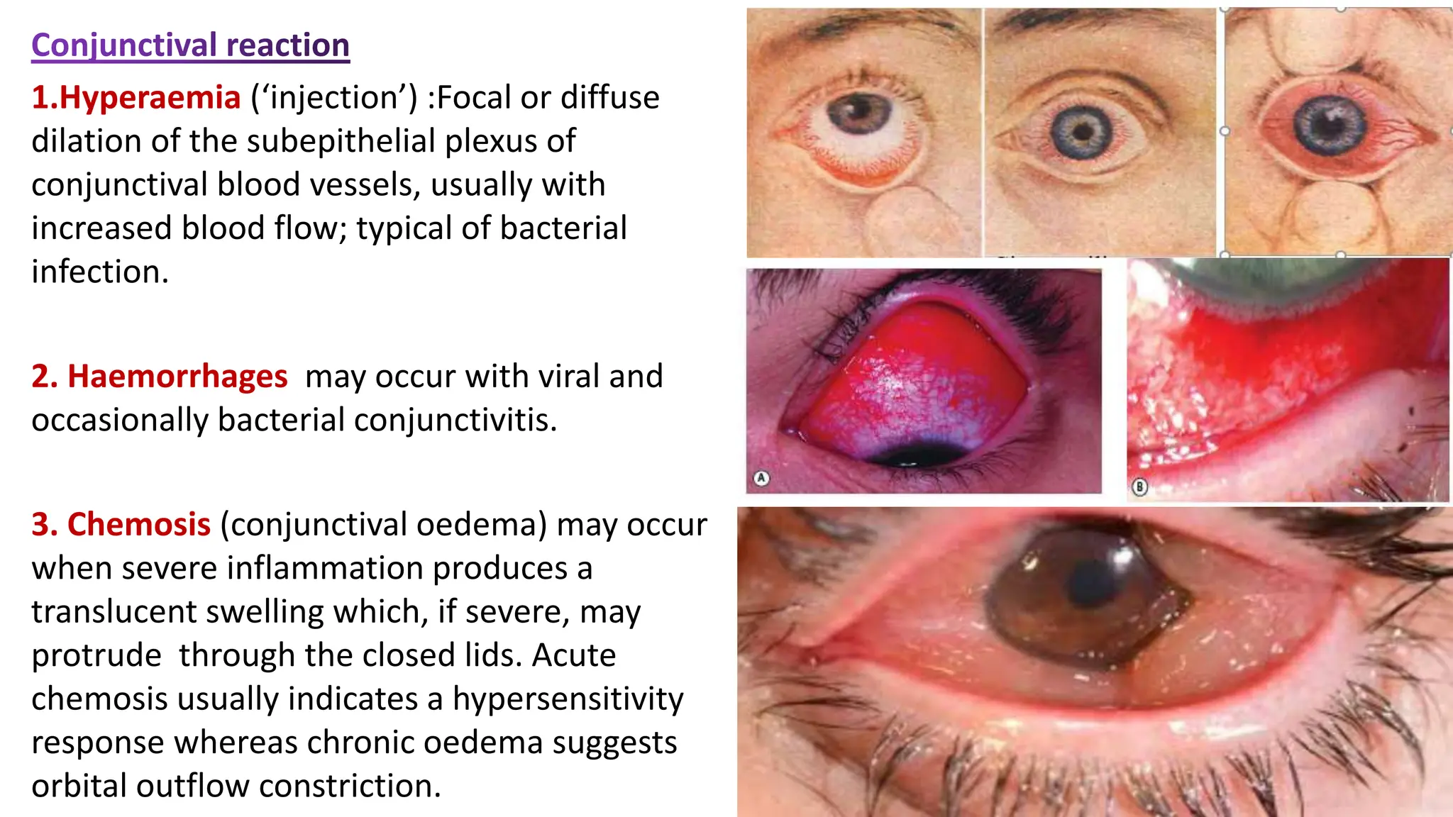 anatomy of conjunctiva. Ophthalmology slides | PPTX