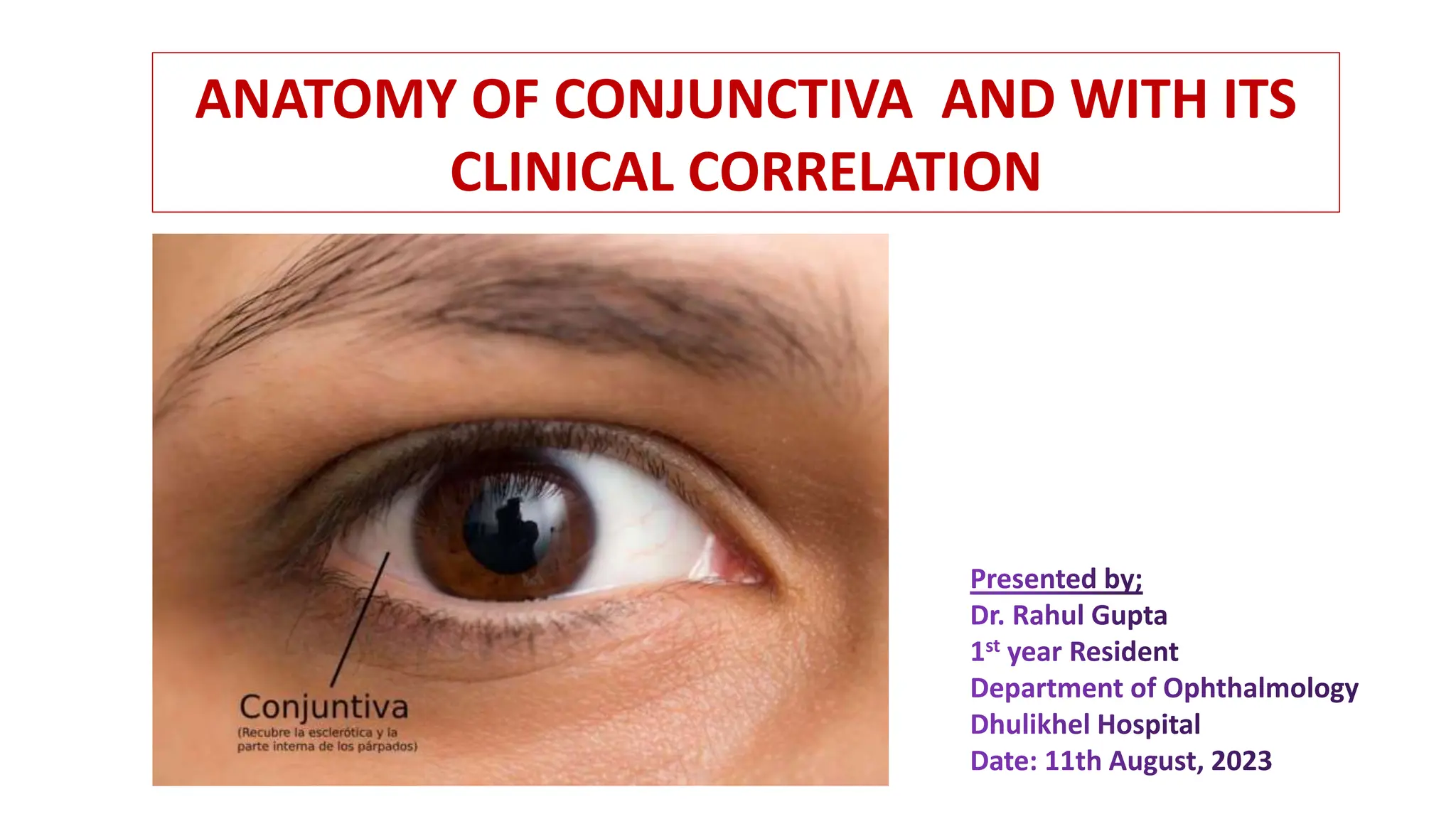 anatomy of conjunctiva. Ophthalmology slides | PPT