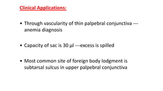 anatomy of conjunctiva. Ophthalmology slides | PPTX