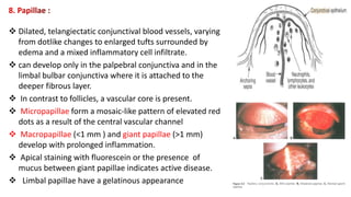 anatomy of conjunctiva. Ophthalmology slides | PPTX