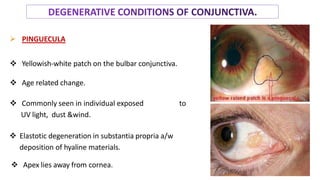 anatomy of conjunctiva. Ophthalmology slides | PPTX