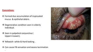 anatomy of conjunctiva. Ophthalmology slides | PPTX