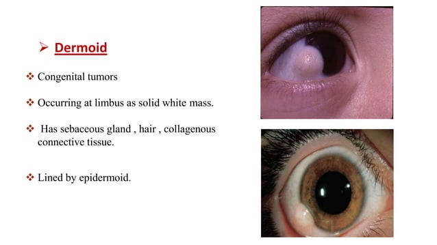 anatomy of conjunctiva. Ophthalmology slides | PPTX | Eye and Vision ...