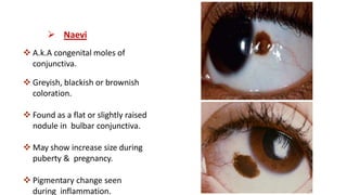 anatomy of conjunctiva. Ophthalmology slides | PPTX