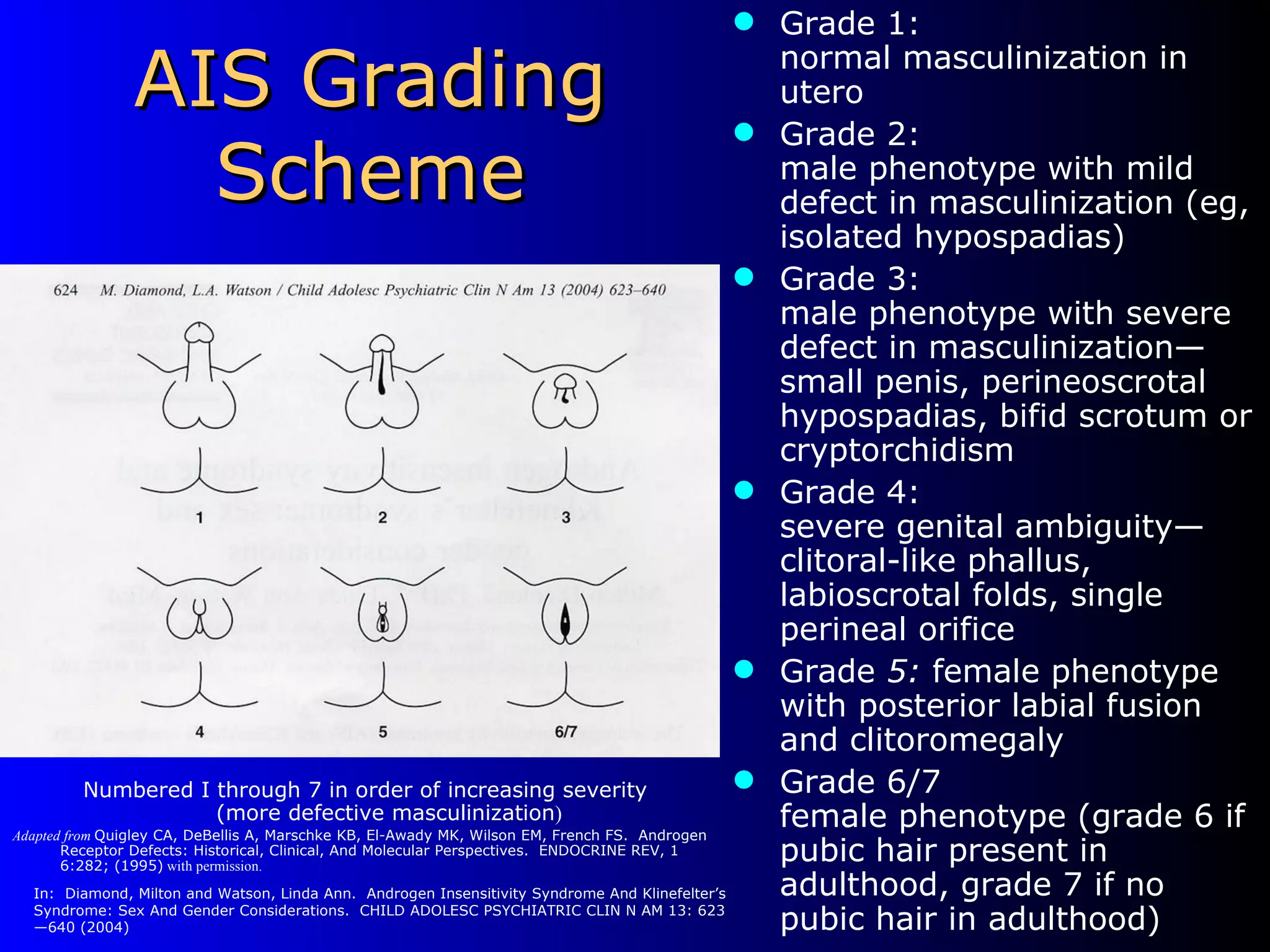 5 Androgen Insensitivity | PPT