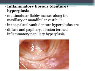 approach to swelling in maxillofacial region | PPTX