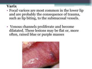 approach to swelling in maxillofacial region | PPTX