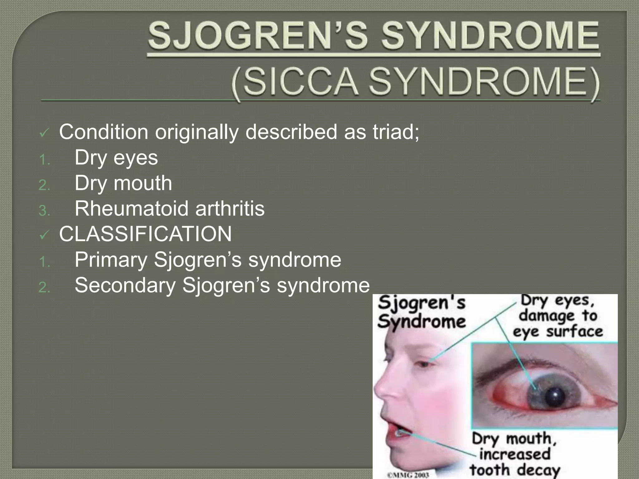 5 AUTOIMMUNE DISEASES OF SALIVARY GLAND SNISHA.pptx