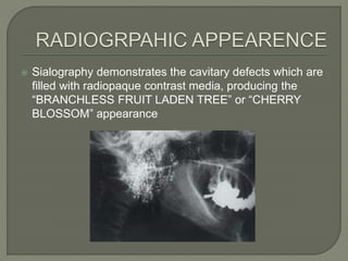 5 AUTOIMMUNE DISEASES OF SALIVARY GLAND SNISHA.pptx | Ear, Nose and ...