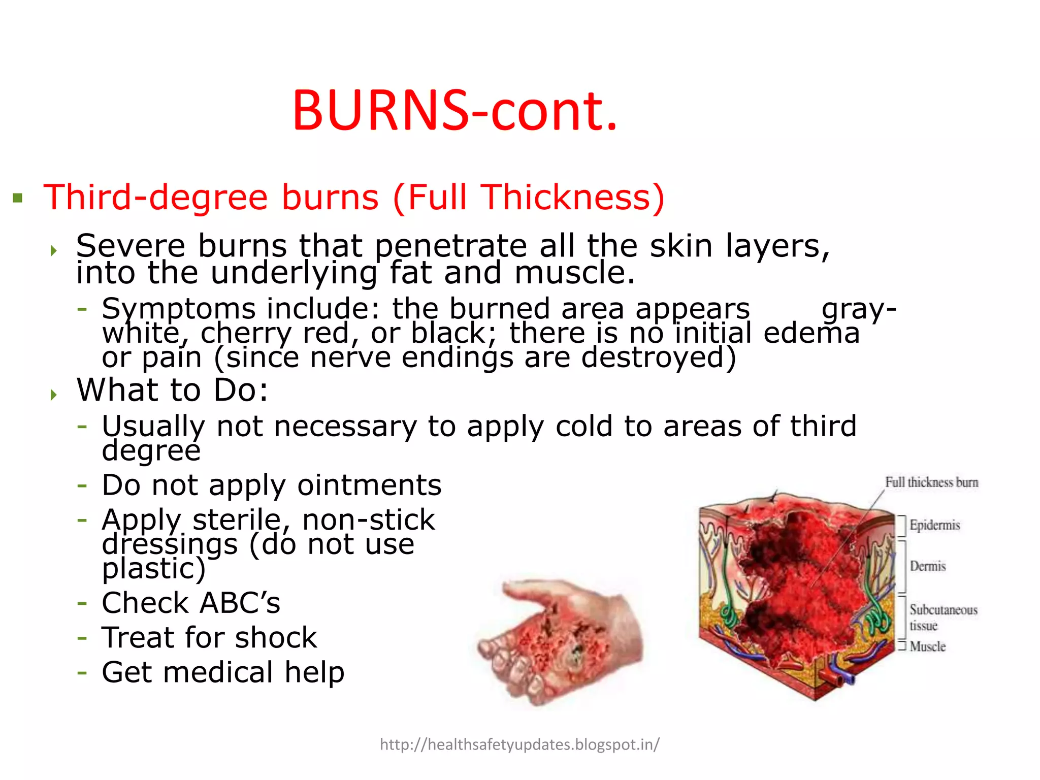 First Aid Training | PPTX