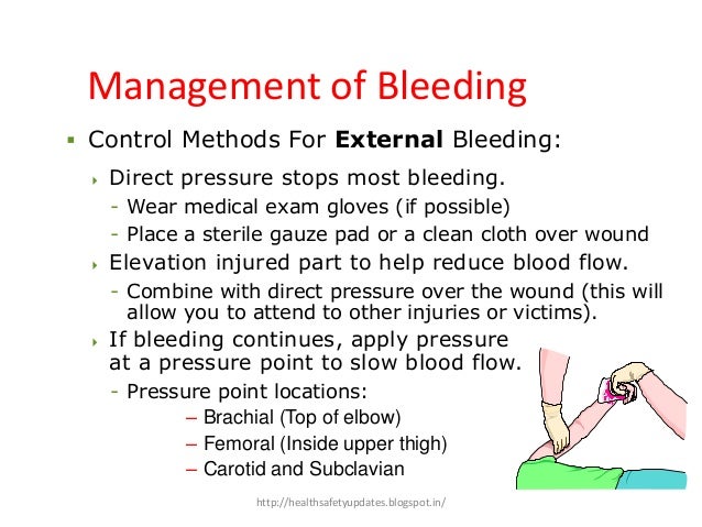 Pressure Points To Stop Bleeding