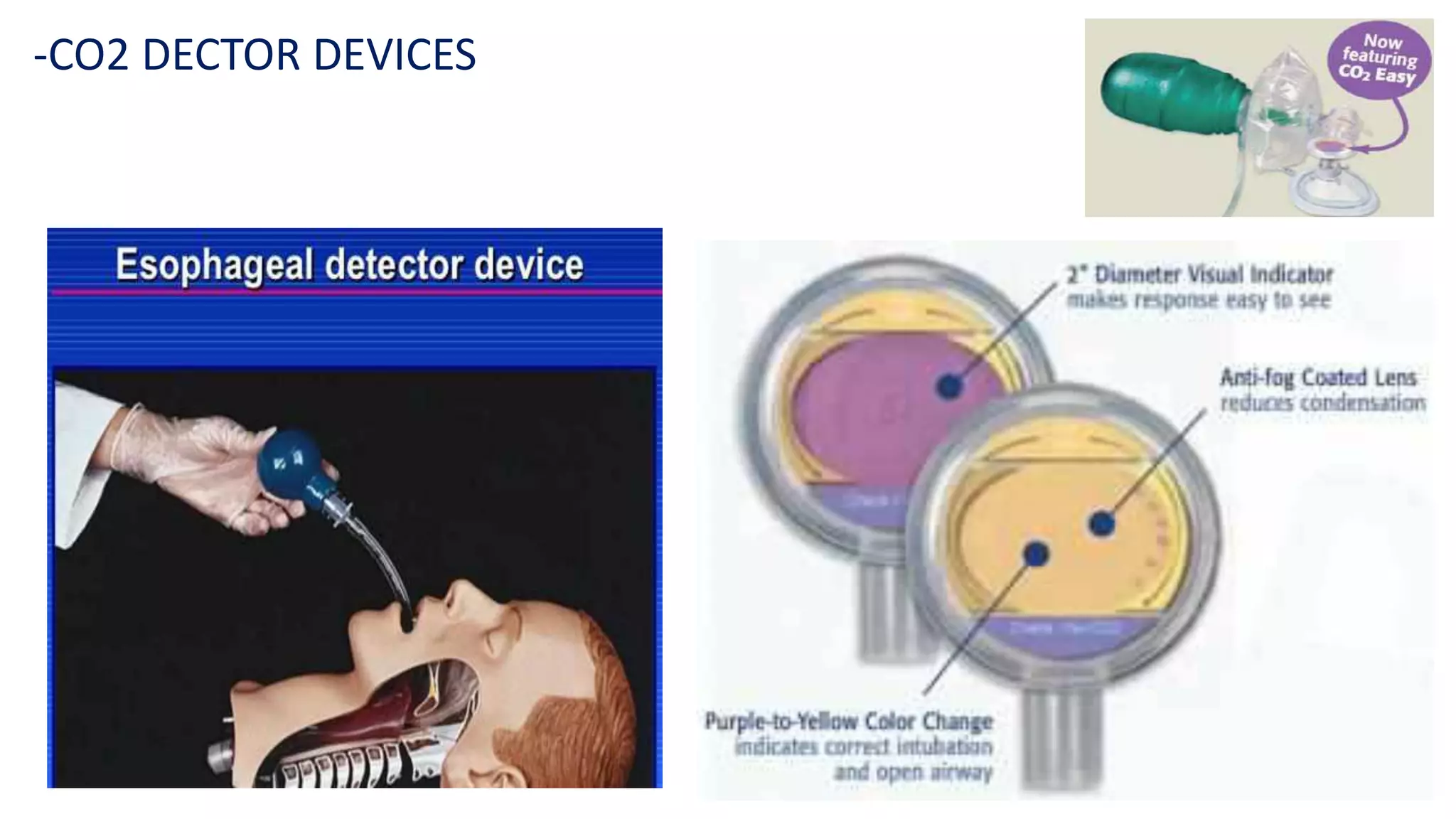 endotracheal intubation and laryngoscopy part-2-Anesthesia | PDF