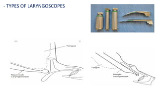 endotracheal intubation and laryngoscopy part-2-Anesthesia | PDF