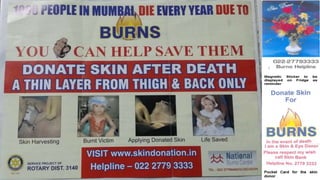 Skin Donation | PPTX