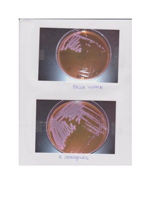 Microbio Sample | PDF