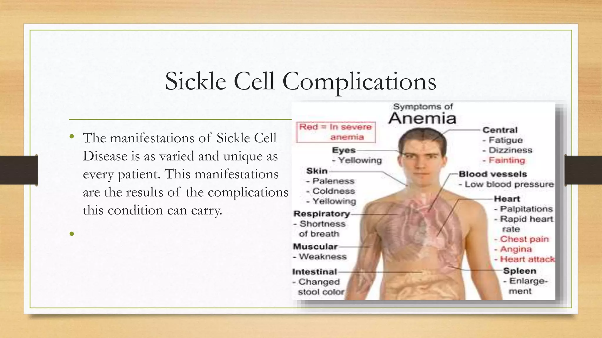 Sickle Cell Complications | PPTX