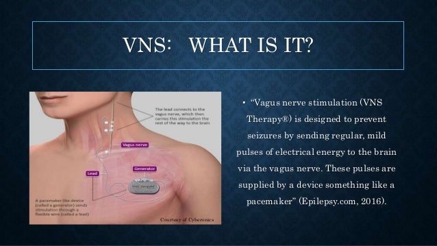 VNS Poster Presentation