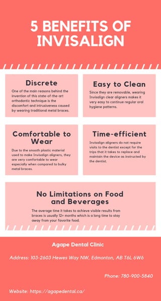 5 Benefits of Invisalign | PDF | Dental Health | Diseases and Conditions