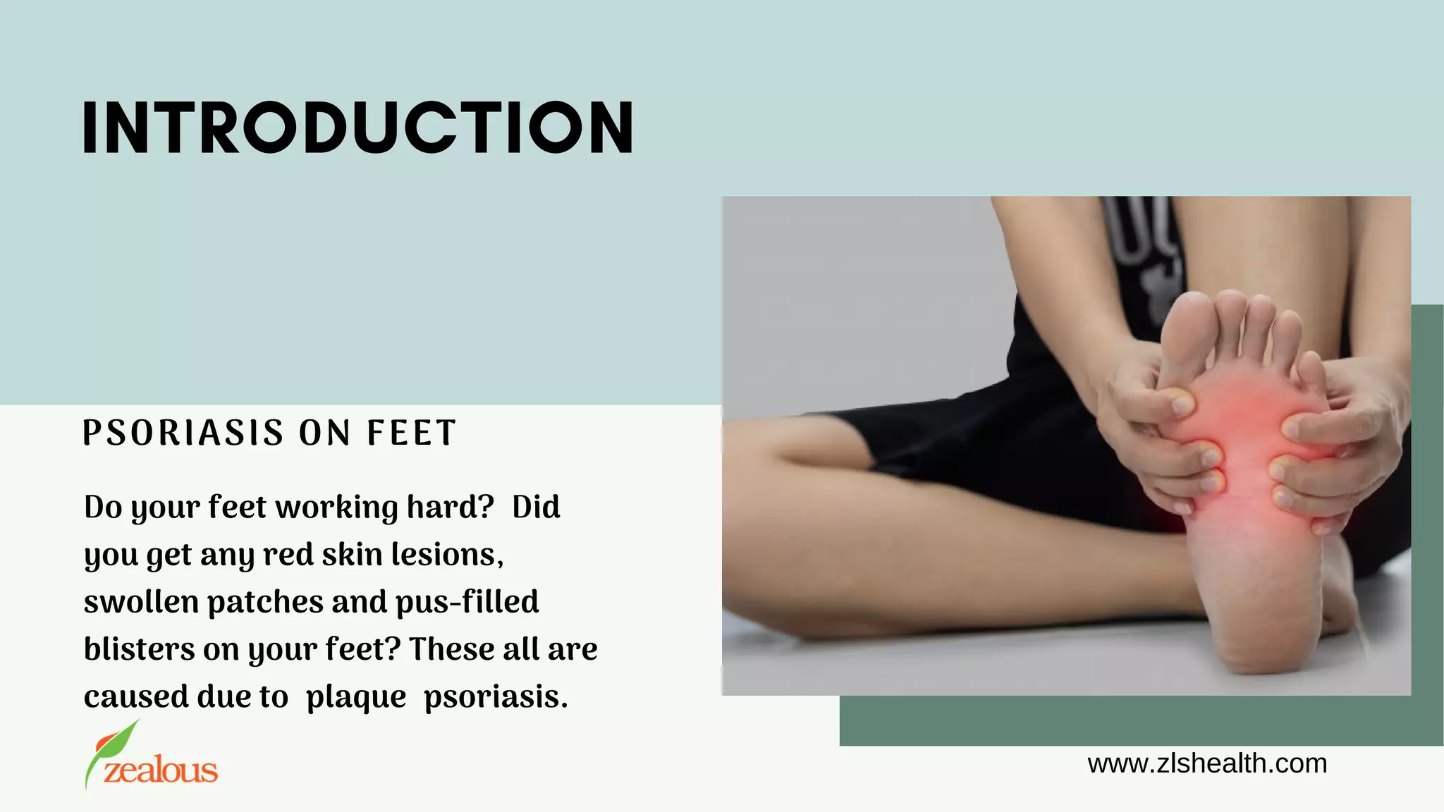 5 best home remedies for psoriasis on feet ( amazing solutions) | PDF