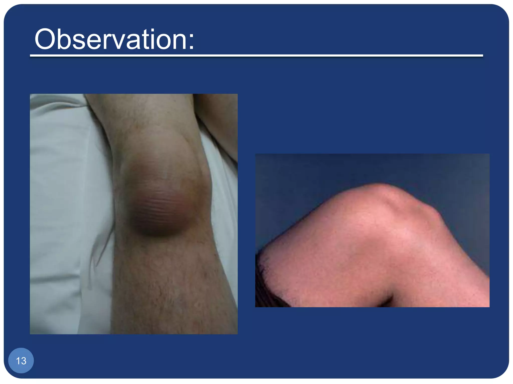 5b observation of Knee Joint | PPTX