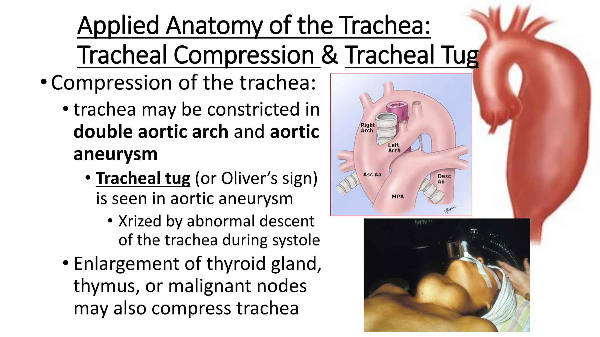 respiraaaaatory5b_Trachea and Bronchi.pdf
