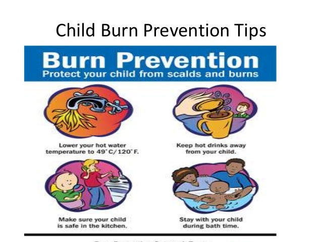 burn prevention india