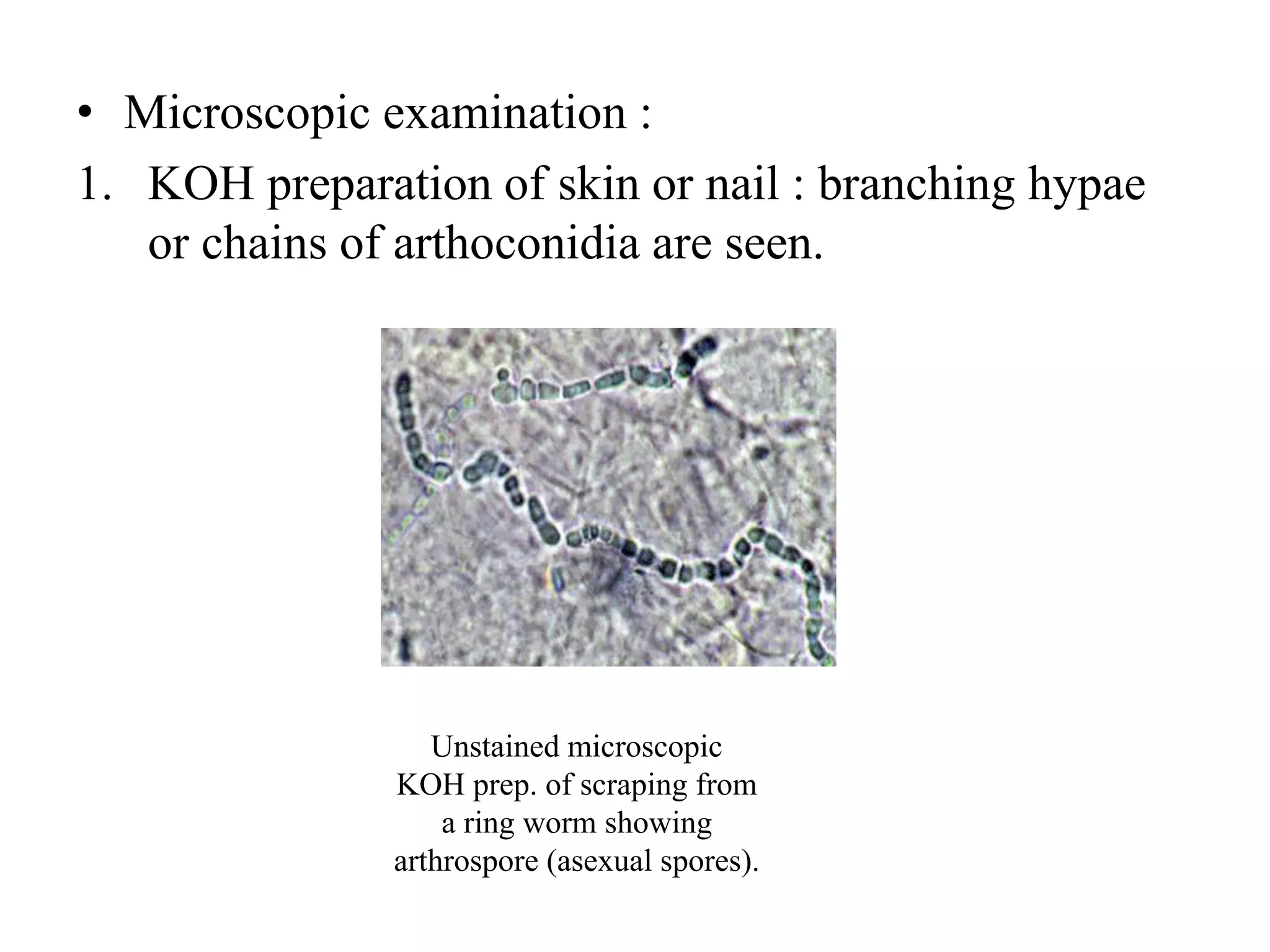 Dermatophytes | PPTX