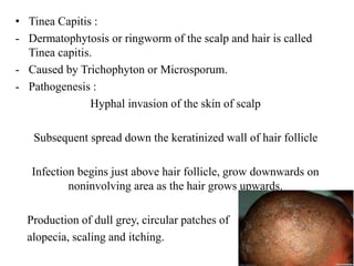 Dermatophytes | PPTX