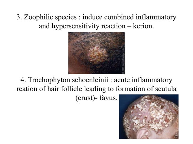 Dermatophytes | PPTX | Foot Health | Diseases and Conditions