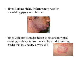 Dermatophytes | PPTX