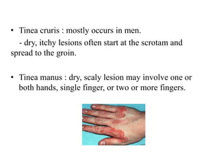 Dermatophytes | PPTX