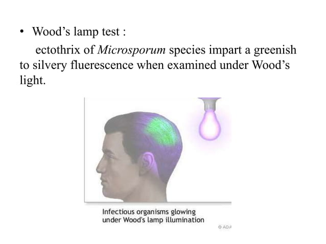 Dermatophytes | PPTX | Foot Health | Diseases and Conditions