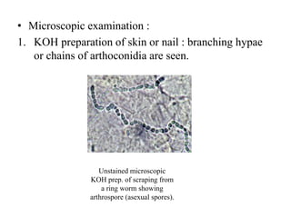 Dermatophytes | PPTX