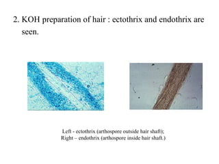 Dermatophytes | PPTX