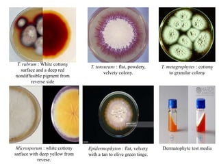 Dermatophytes | PPTX